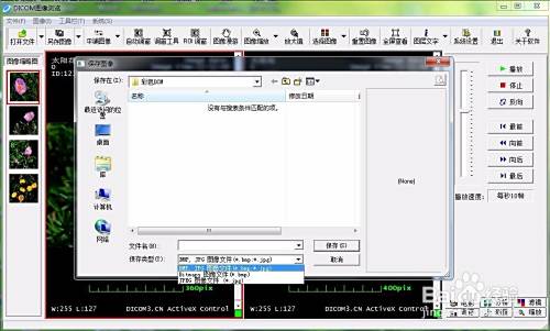 dcm文件怎么打开-百度经验